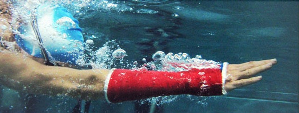 Waterproof Cast OrthoH2O Delta Dry AquaCast