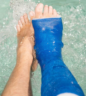 Waterproof Cast OrthoH2O Delta Dry AquaCast
