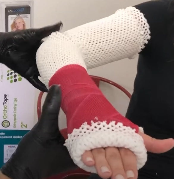 Waterproof Cast | Long Arm Cast Kit - OrthoNeal