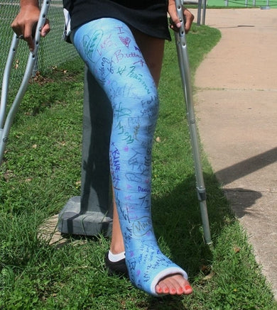 Long Leg Cast - Medical Cast