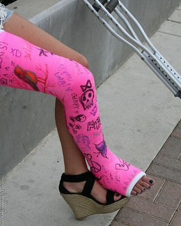 Long Leg Cast - Medical Cast